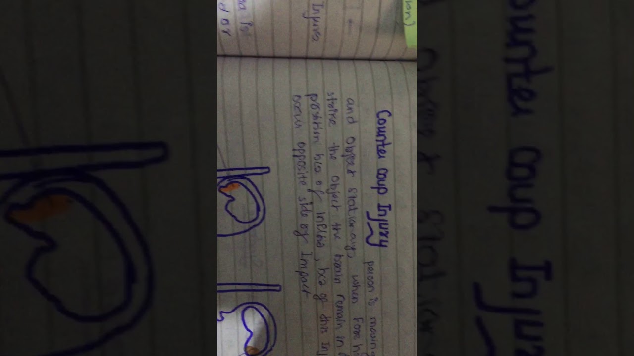 difference between coup and counter coup injury - YouTube