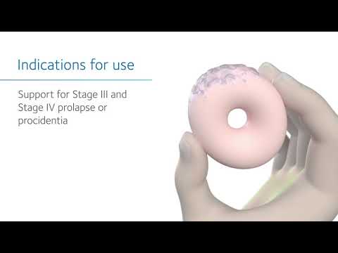 Does Medicare Cover Pessary Device