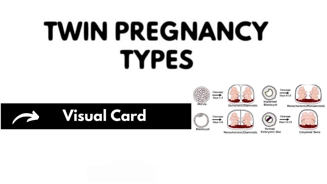 Twin Pregnancy Types With Mnemonic | Obstetrics Mnemonics | Dr Mubashar ...