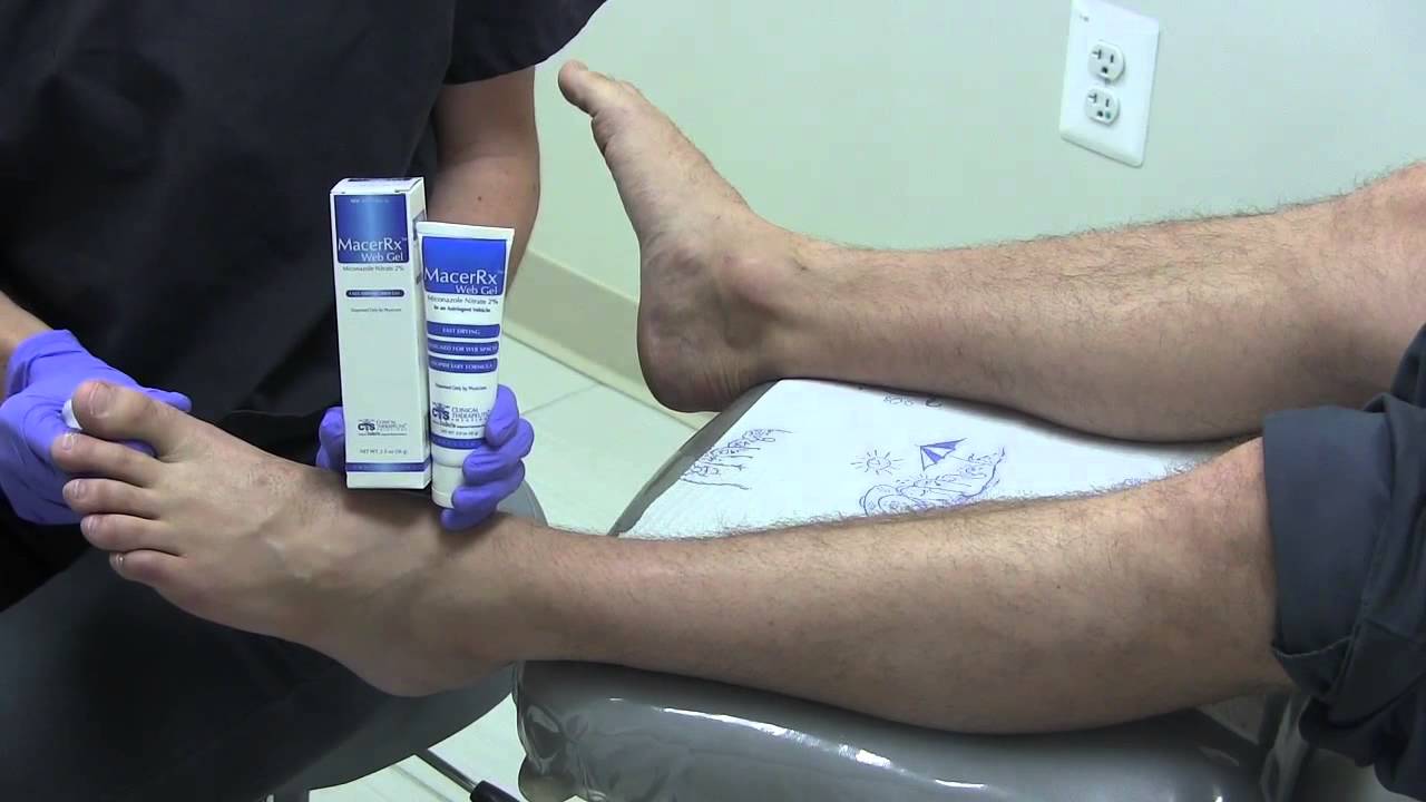 Macerx Web Gel - YouTube