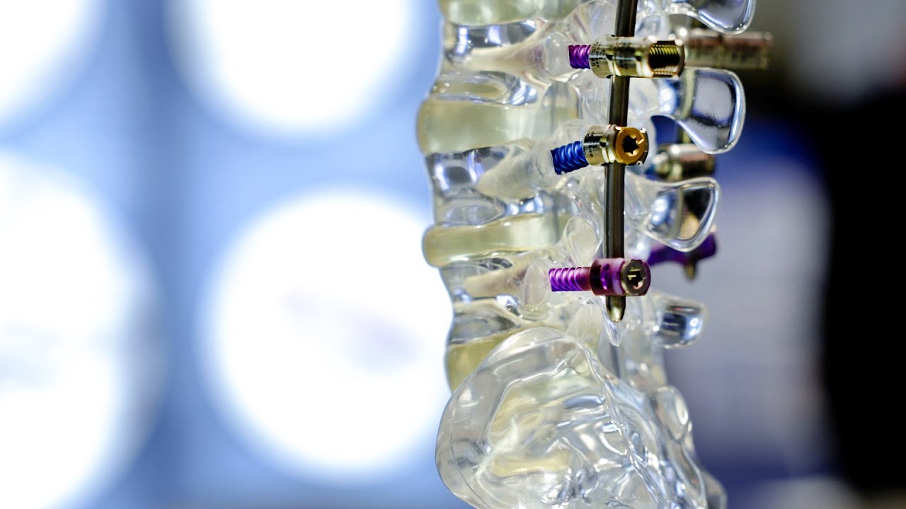 Medical manufacturing of spinal instruments and implants - YouTube
