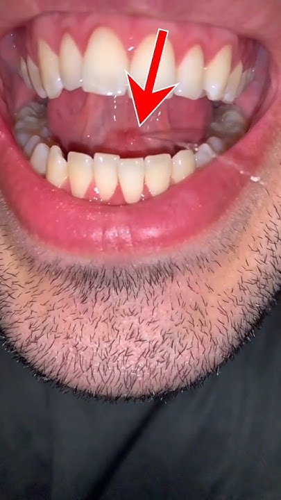 How to do Gleeking 😨 - YouTube