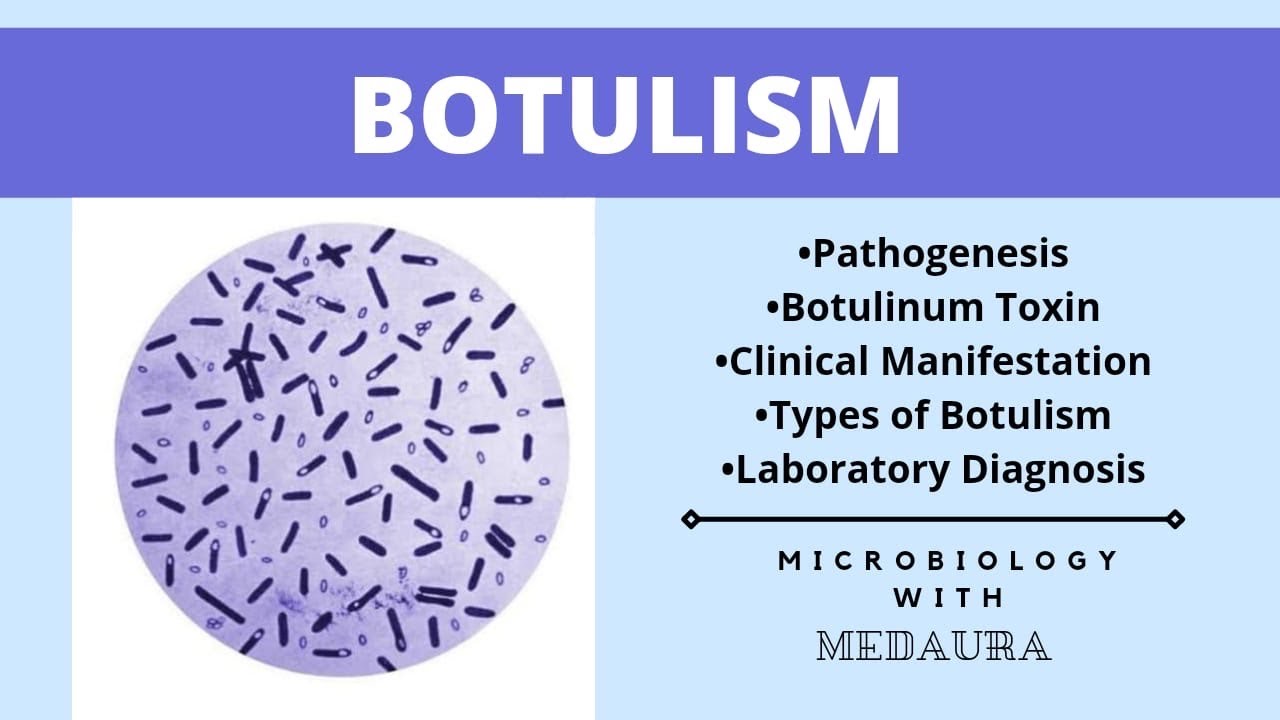 Botulism || Clostridium Botulinum || Microbiology || 2nd MBBS ...