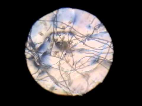 Hay Infusion Sample - YouTube