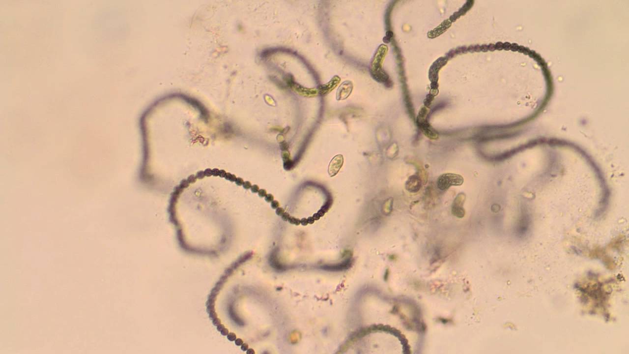 Protozoa feeding on a decaying colony of Anabaena cyanobacteria - YouTube