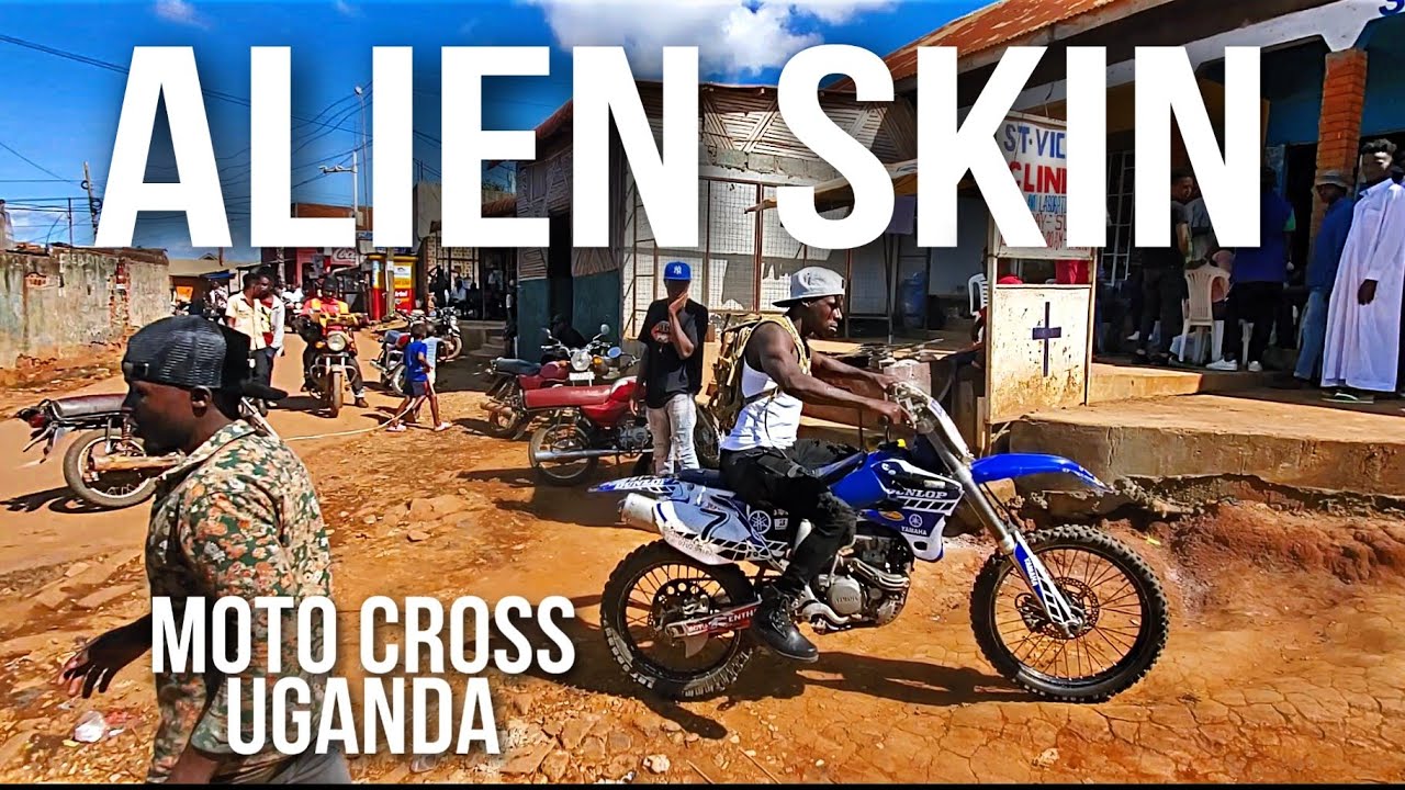Alien skin Is Joining Moto Cross Uganda for a A Gold 🥇 Medal - YouTube