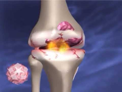 Winofit Omega3 - YouTube