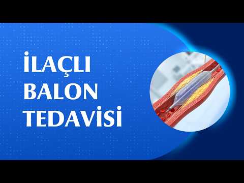 İlaçlı Balon Tedavisi Her Hastaya Uygulanır mı?