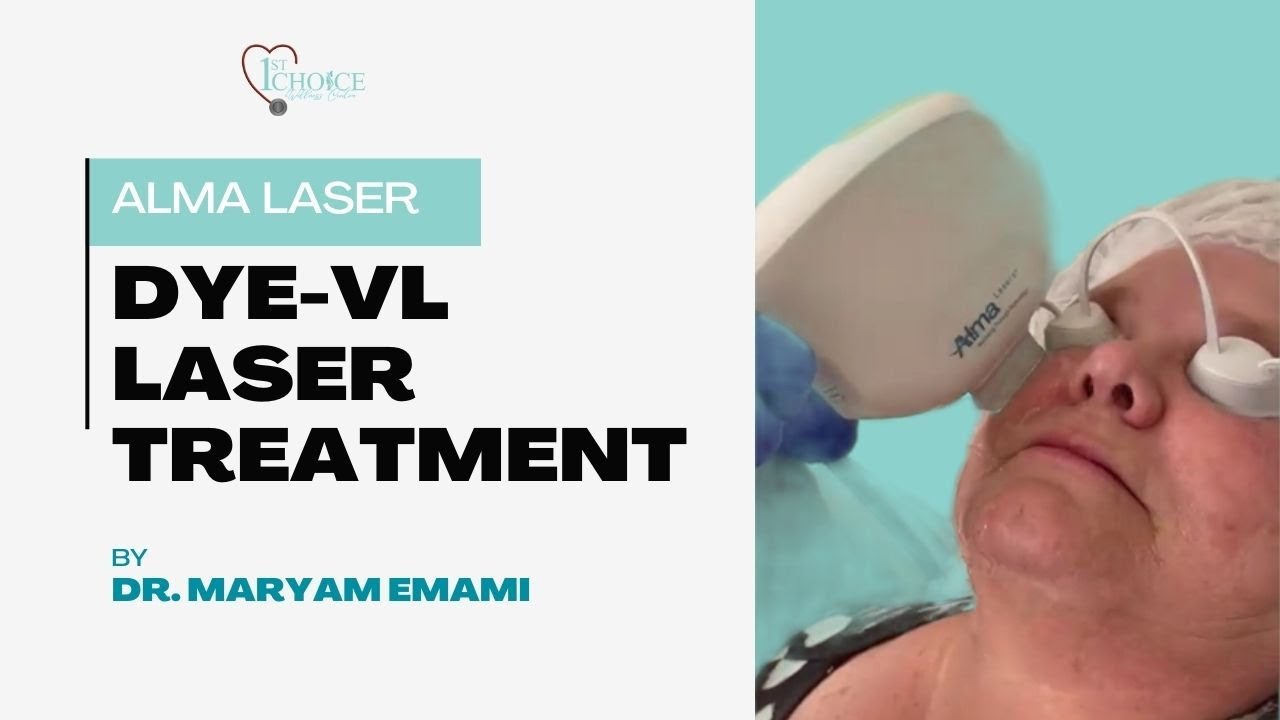 DYE-VL LASER TREATMENT - YouTube