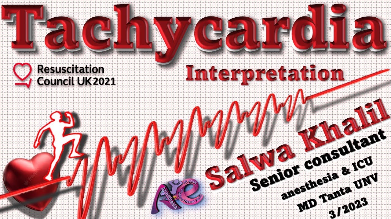 ECG 4 Tachycardia Interpretation and management according to UK ...