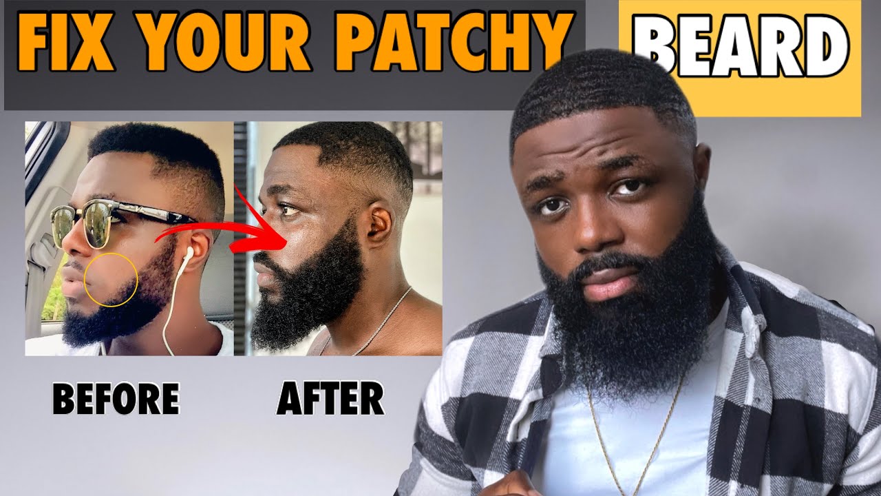 The Smartest Ways To Fix A Stubborn Patchy Beard( 4 easy ways) - YouTube