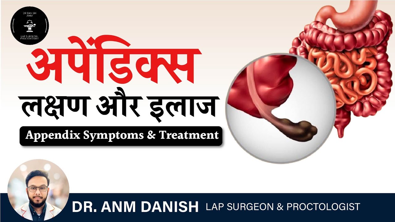 All About Appendicitis | Appendix Symptoms & Treatment In Hyderabad ...