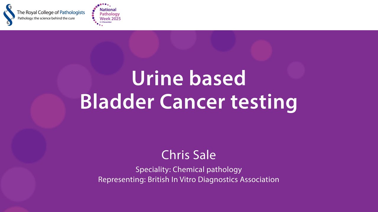 How tests help patients - Urine based Bladder Cancer testing - YouTube