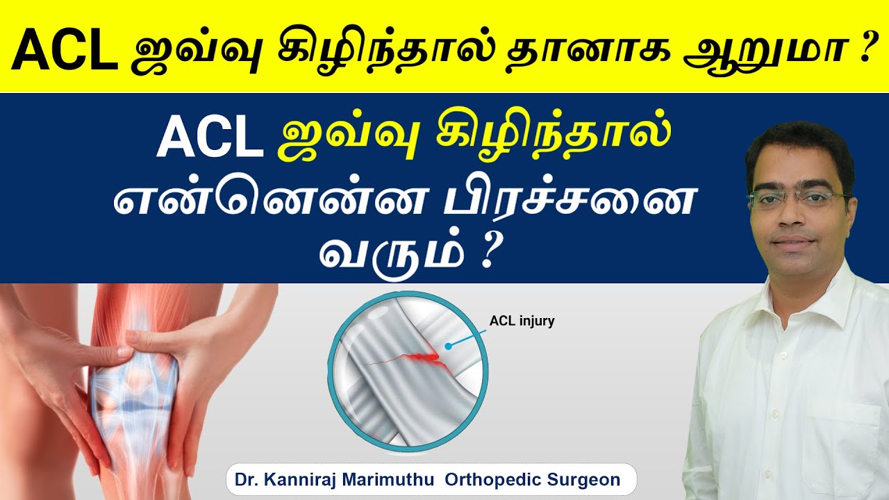ACL ஜவ்வு கிழிந்தால் என்னென்ன பிரச்சனை வரும் ? ACL ஜவ்வு கிழிந்தால் ...