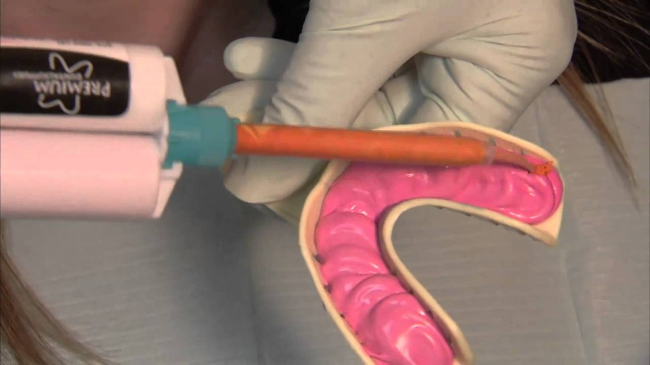 How to take one step impressions - YouTube