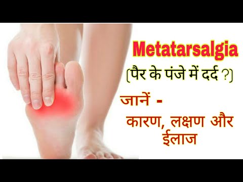 Metatarsalgia treatment in hindi | पंजों में दर्द का कारण और उपाय