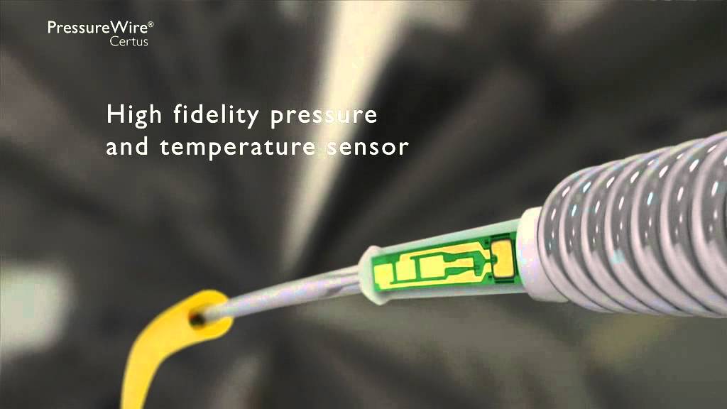 RADI pressurewire - YouTube