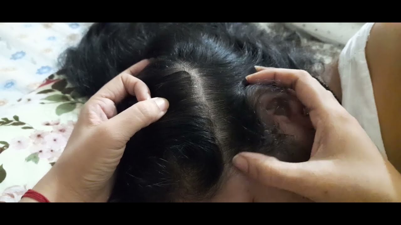 Long hair scalp checking video - YouTube