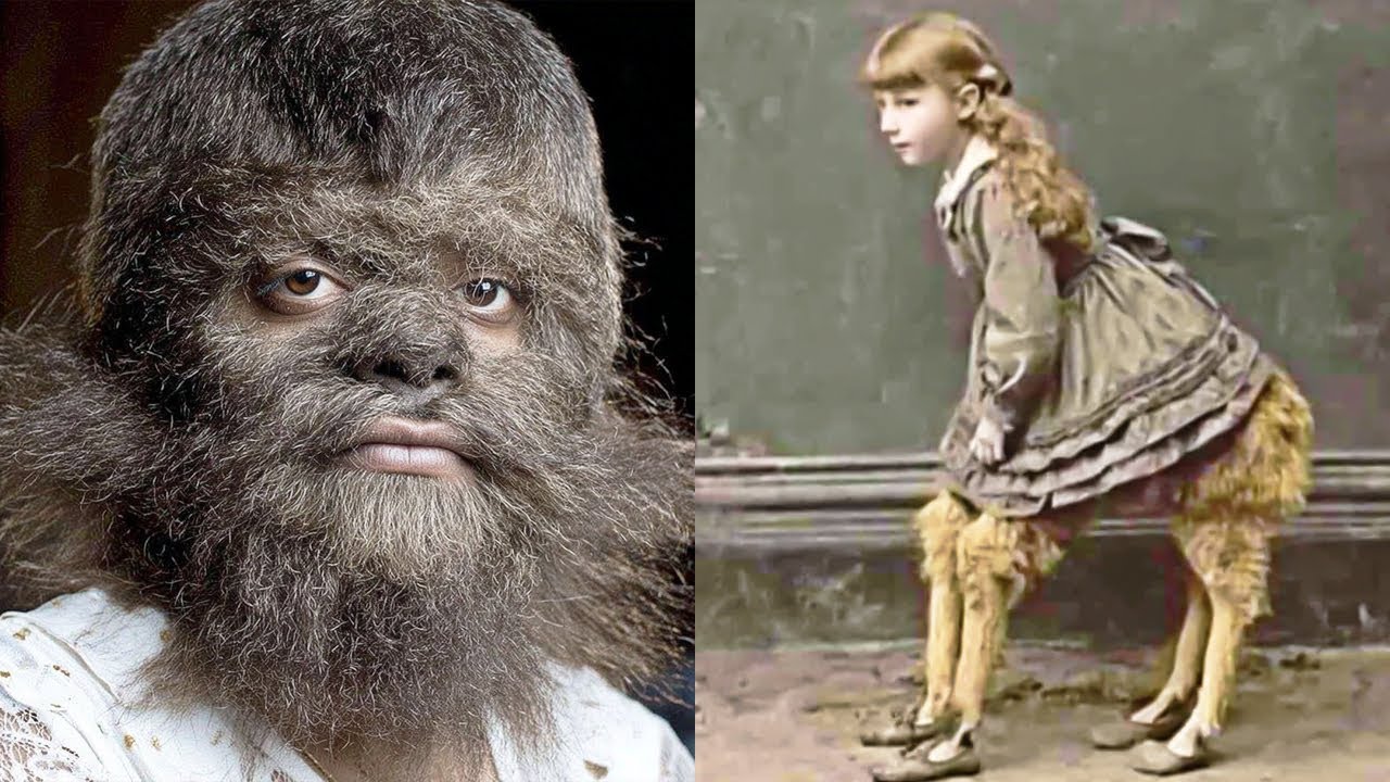 Weirdest Humans You Won't Believe Exist! - YouTube