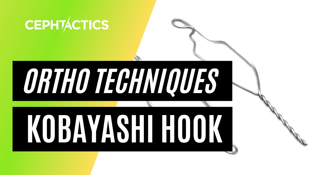 Koyabashi hooks in Orthodontics - YouTube