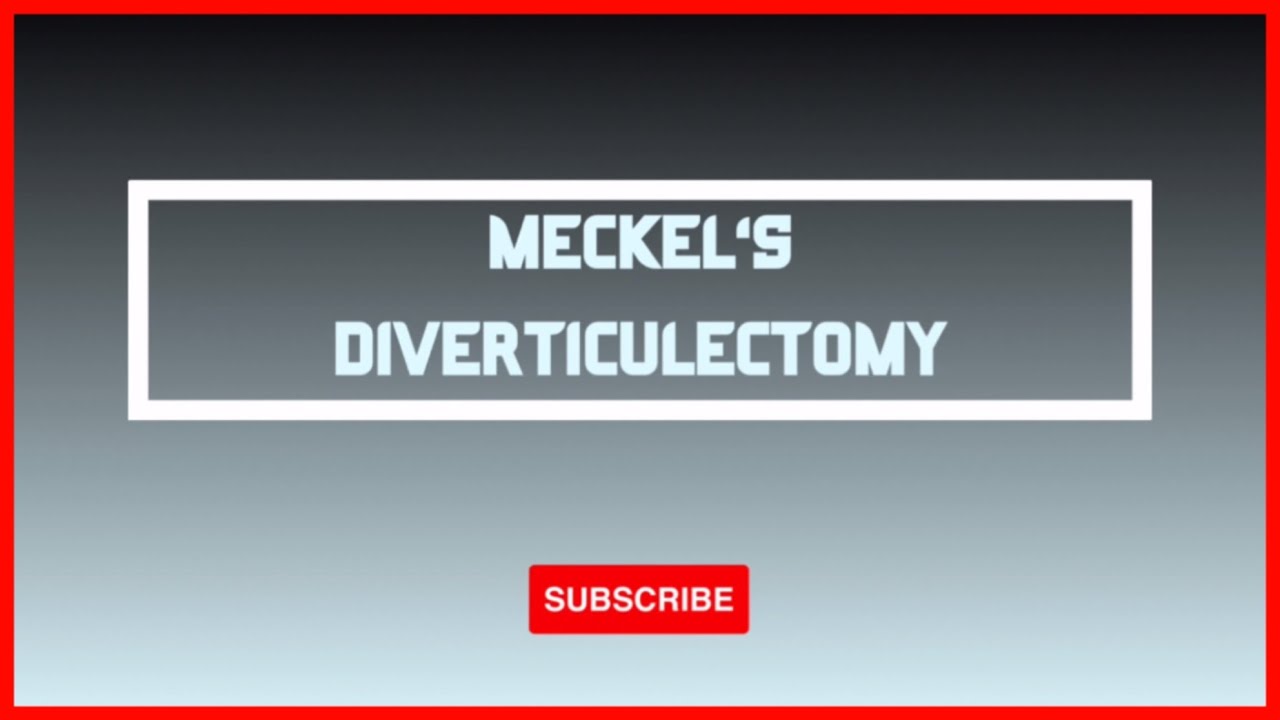ETC 004, Laparoscopic Meckel's Diverticulectomy - YouTube