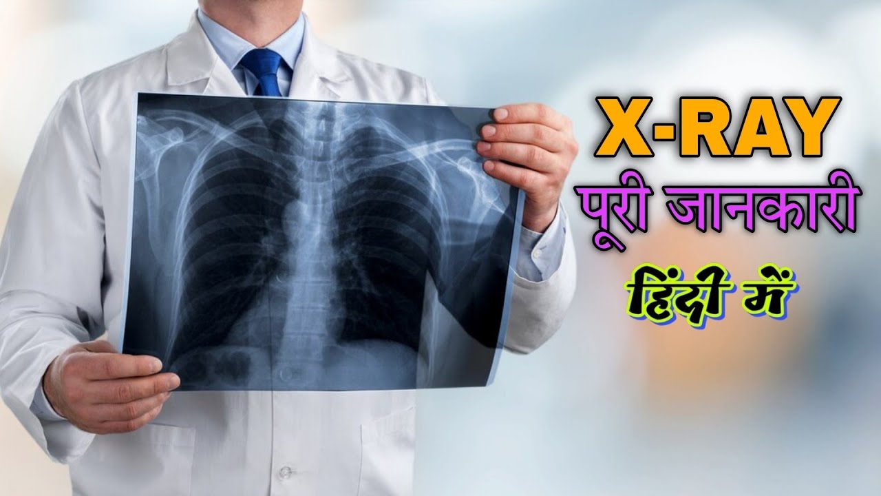 What is X-RAY Full Information? - [Hindi] – The Learning Support - YouTube