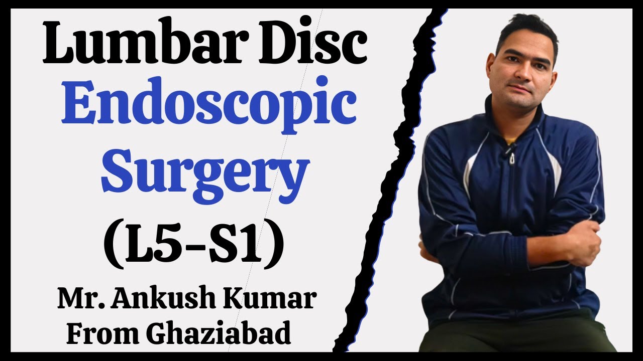 Lumbar Disc Endoscopic Surgery (L5-S1) | - YouTube