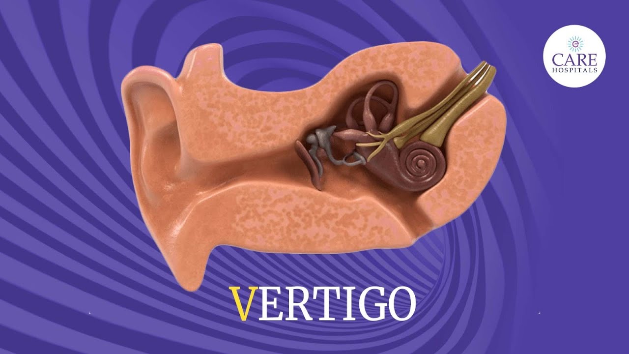 What is Vertigo? | How to Overcome Vertigo? - YouTube