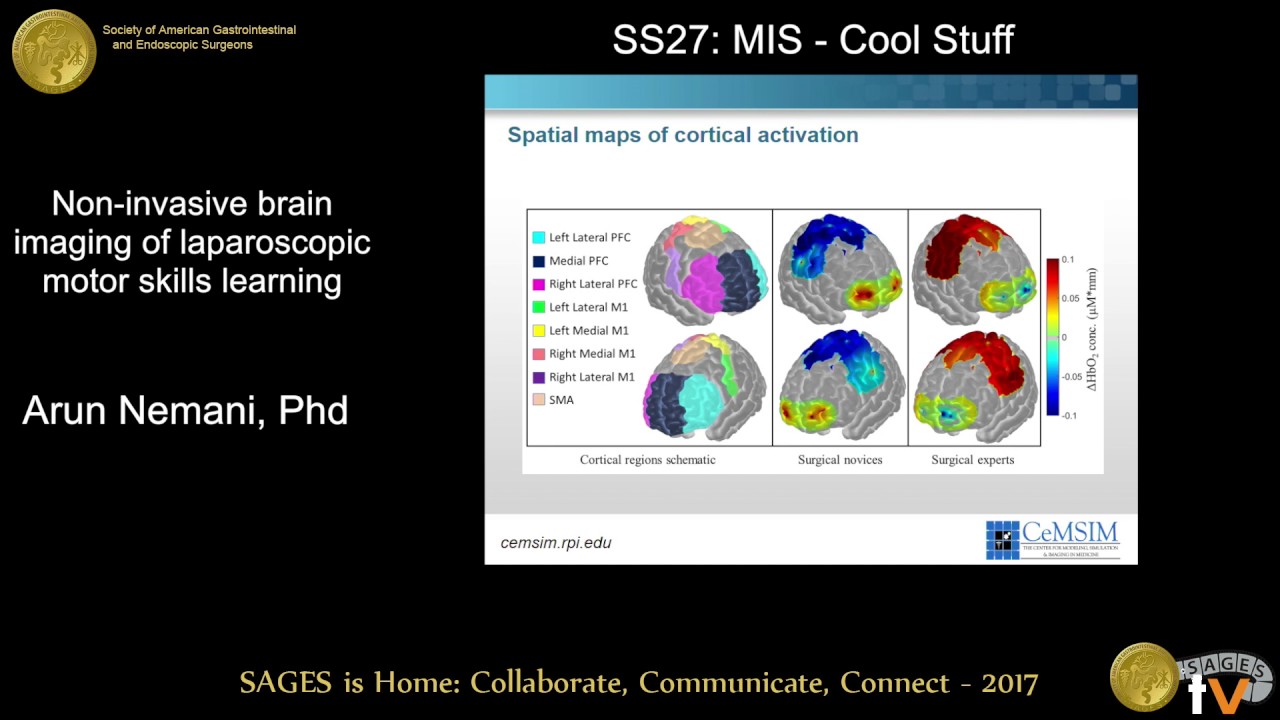 Non-invasive brain imaging of laparoscopic motor skills learning - YouTube