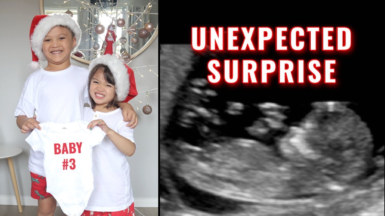 WHY MY WISDOM SURGERY GOT CANCELLED... | Baby surprise | Hannah Borja ...