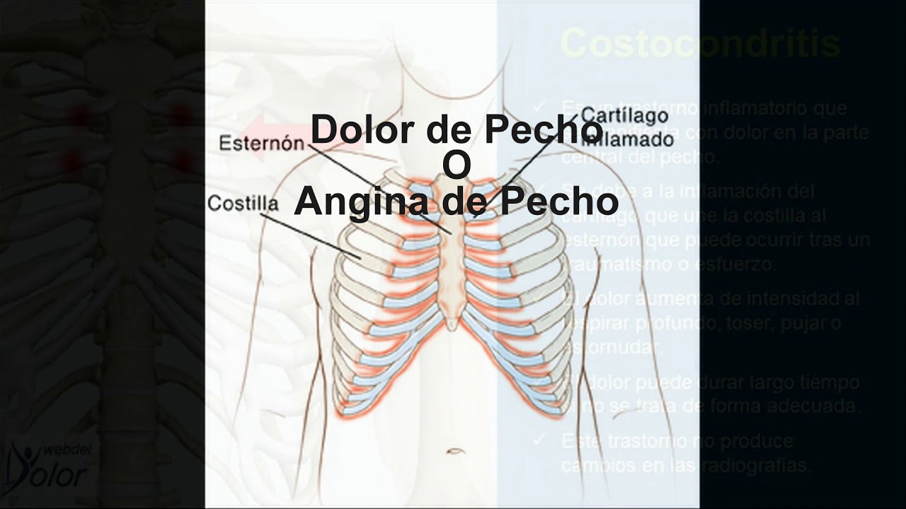Dolor de Pecho o Angina de Pecho - YouTube
