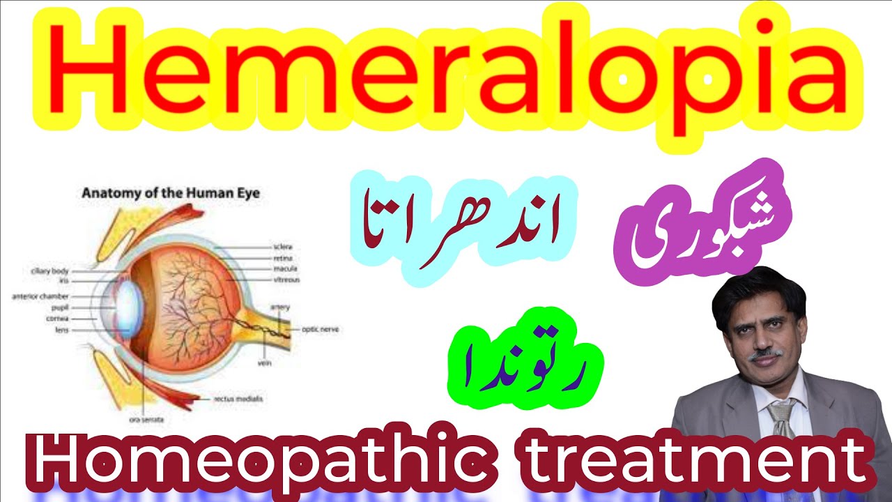 hemeralopia / اندھراتا / شبکوری / Day Blindness ! Homeopathic Medicine ...