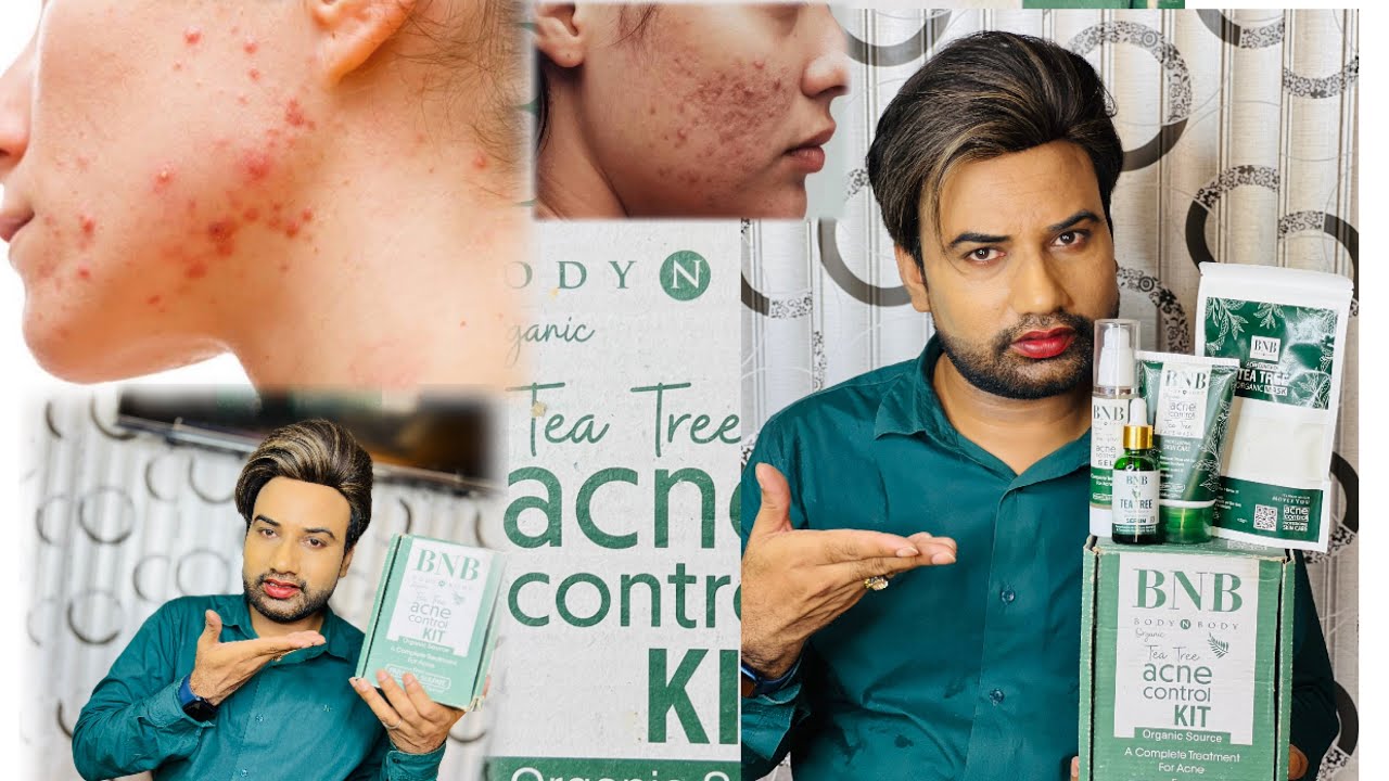 BNB Acne Control Tea Tree kit Honest Reviews // body and body acne ...