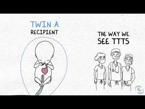 Twin Twin Transfusion presentation Part 1