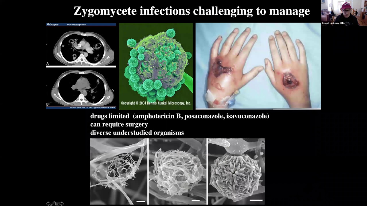 Joe Heitman: RNAi-dependent epimutations evoke transient antifungal ...