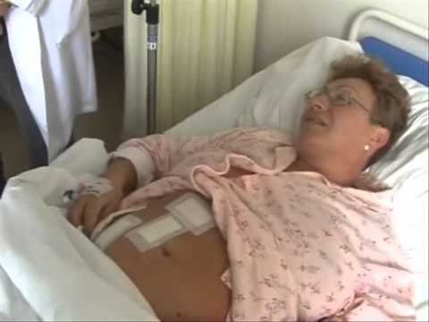 раздвижване на пациет след лапароскопска операция