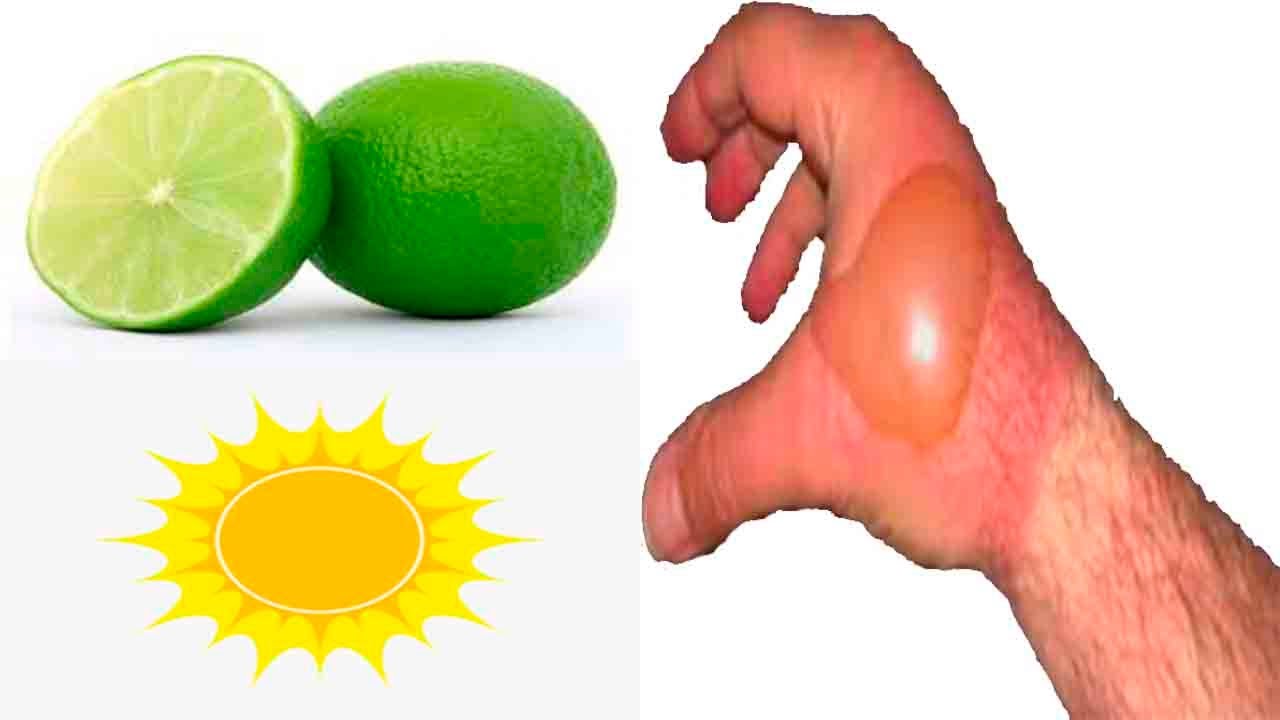 Limón y Sol, Una Combinación Peligrosa. - YouTube