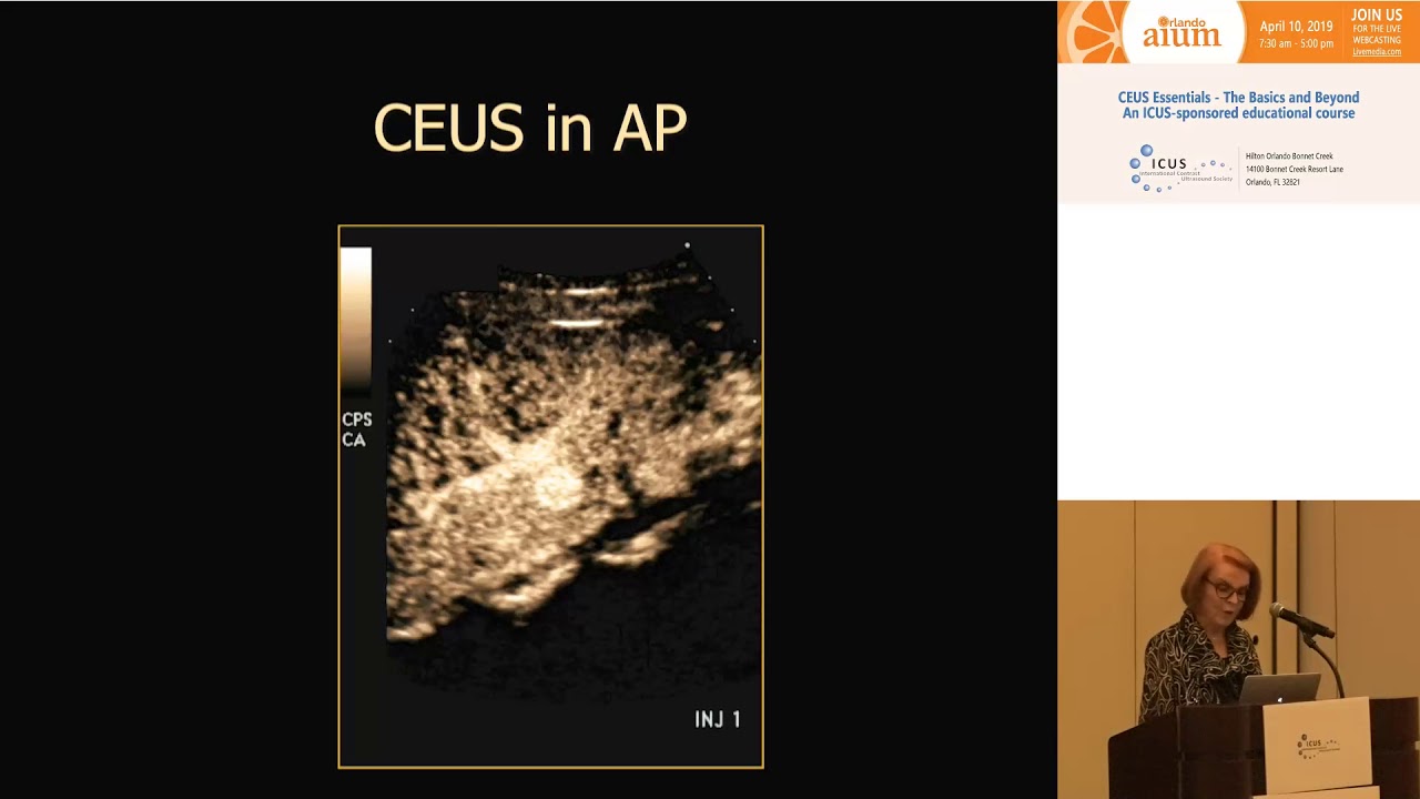 Fundamentals of interpretation of Liver CEUS - YouTube