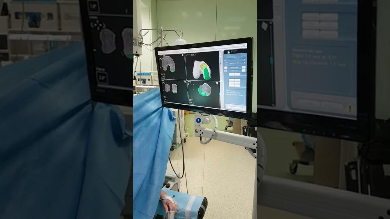 ΡΟΜΠΟΤΙΚΗ ΧΕΙΡΟΥΡΓΙΚΗ ΓΟΝΑΤΟΣ ΒΙΝΤΕΟ 1 - YouTube