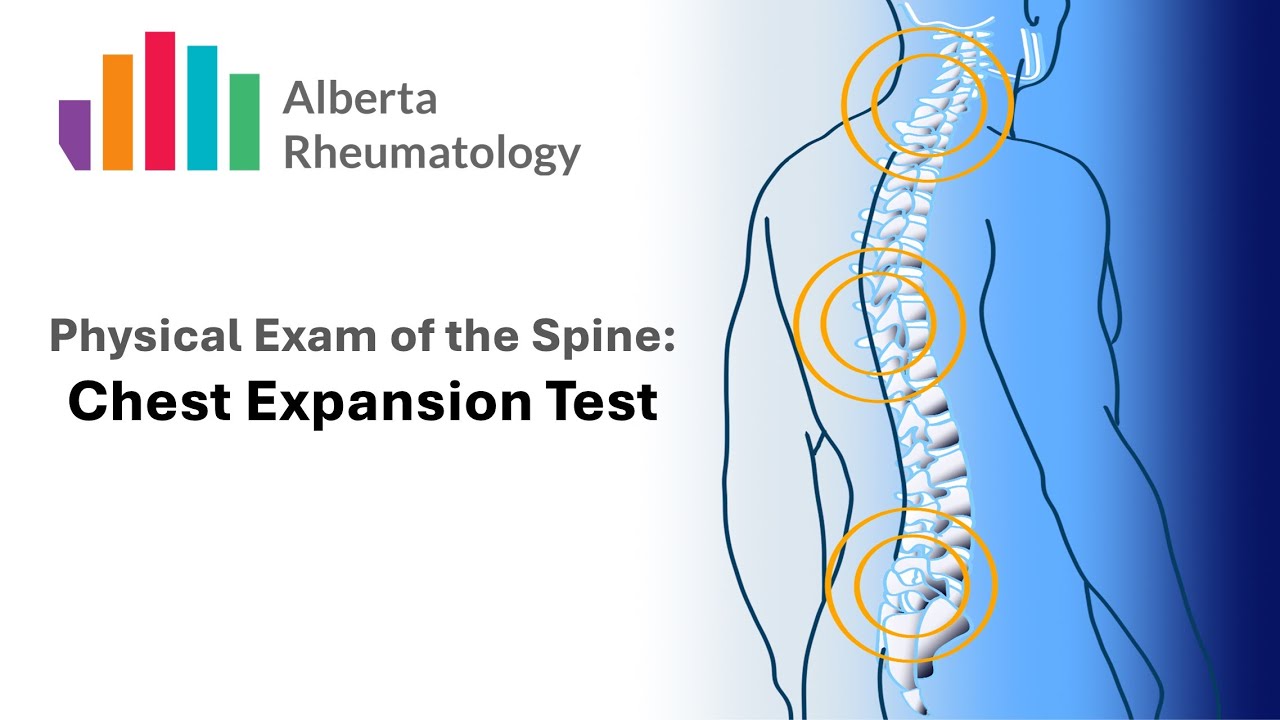 Rheumatology BACK exam: Chest Expansion Test - YouTube