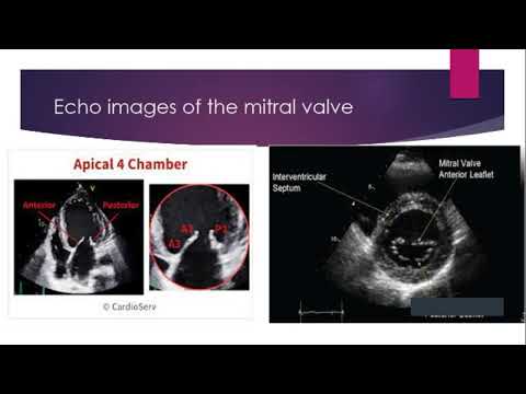 ECHOCARDIOGRAM:HEART VALVES - YouTube
