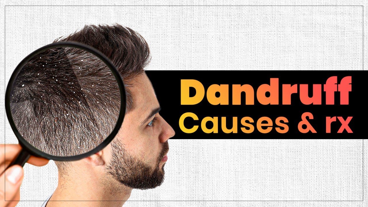 The REAL Cause and Cure for DANDRUFF 🤔 | Dandruff Treatment | New Roots ...