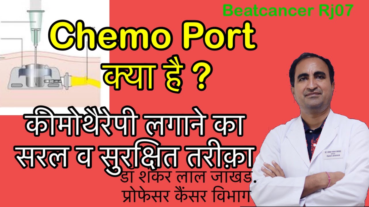 Chemo port: कैनुला लगाये बिना कीमोथैरेपी कैसे दें(How to give ...