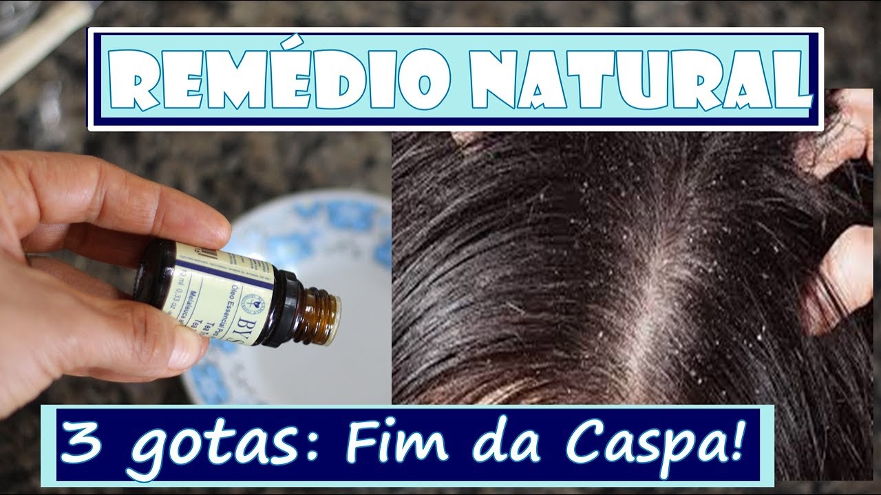 ELIMINANDO A CASPA COM ESSE SURPREENDENTE REMÉDIO NATURAL - Fran Adorno ...
