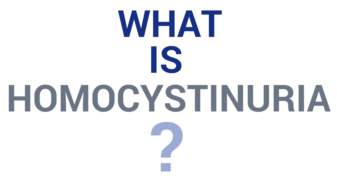 Homocystinuria Infographic - YouTube