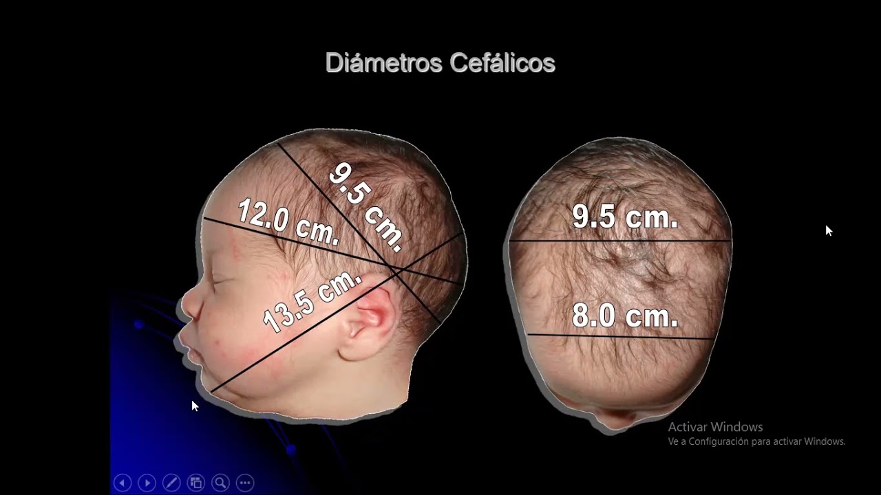 PRESENTACIÓN CEFALICA DE VÉRTICE | GINECOLOGÍA - YouTube