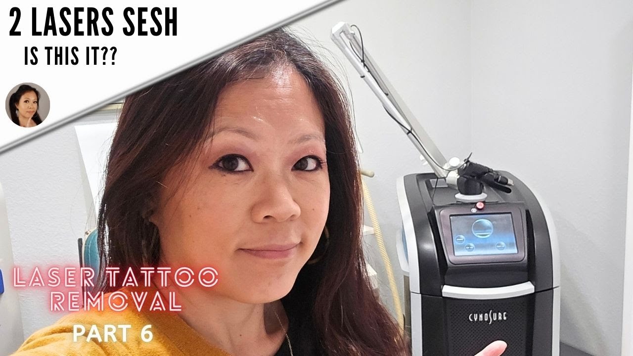 4th Microblading laser removal session: Using 2 lasers-Part 6 - YouTube