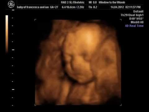 4D Scan of Baby Girl 27+0 weeks - YouTube