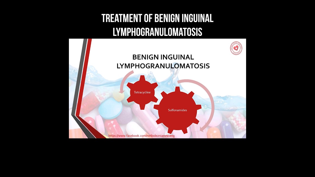 Treatment of benign inguinal lymphogranulomatosis #infection #lymphoma ...