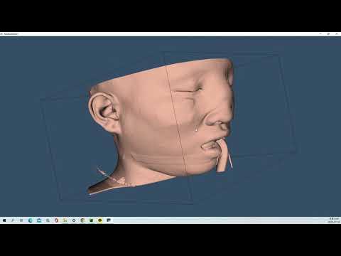 VTK Python Example - MedicalDemo1 - YouTube